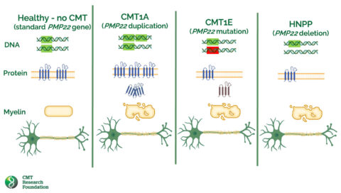Charcot-Marie-Tooth Disease Type 1 Guide | CMT Research Foundation